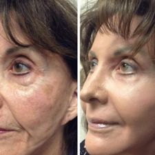 Ashish Sachdeva, MD - 9401 W Thunderbird Rd #155, Peoria, AZ 85381 ...